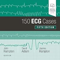150 ECG Problems: Hampton DM MA DPhil FRCP FFPM FESC, John ...