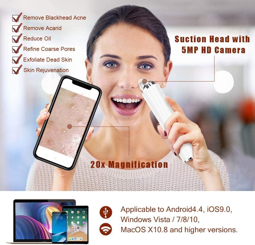 Blackhead Remover Vacuum with Camera, TIMESISO Visible Acne Comedone ...