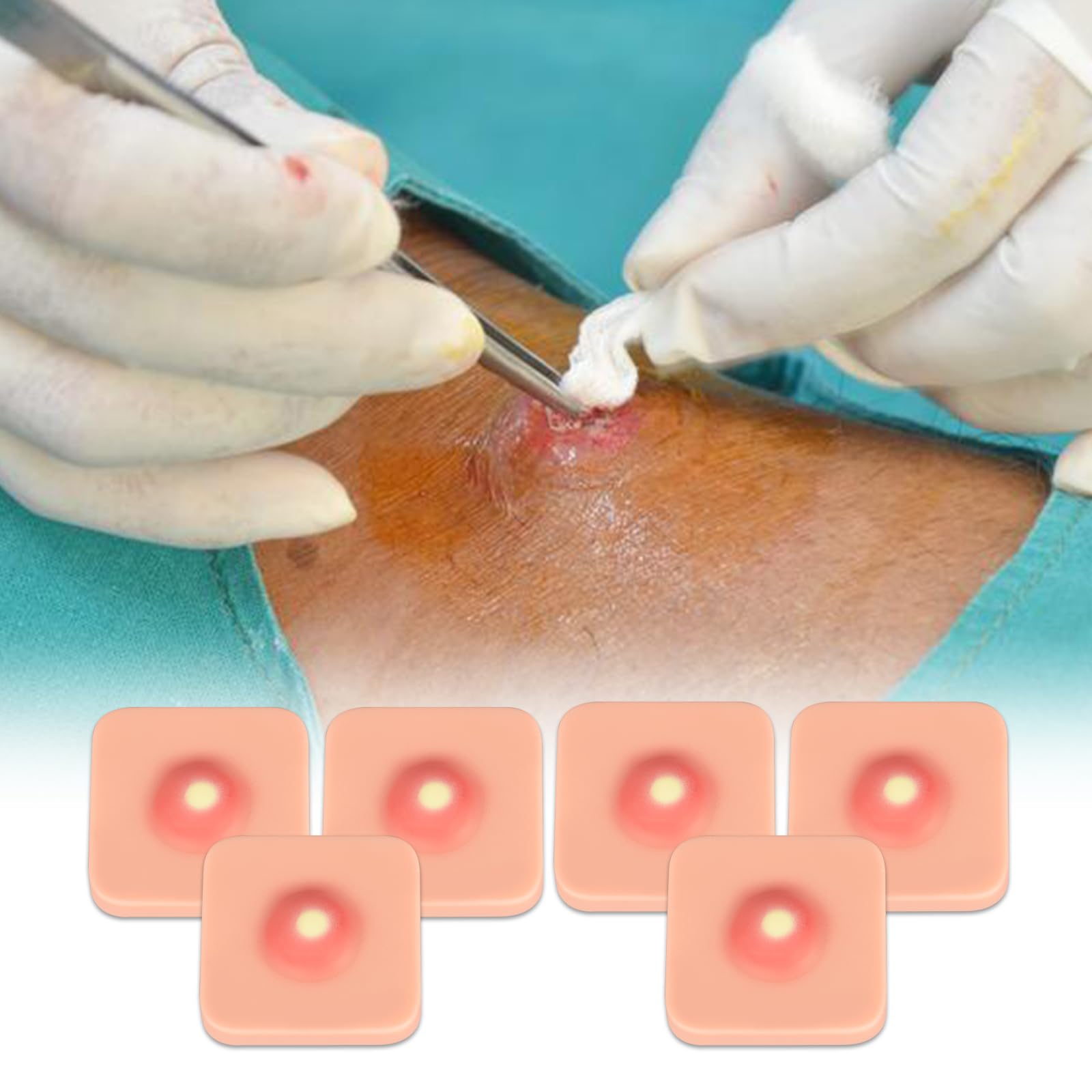 Mua Ultrassist Abscess I&D Incision and Drainage Pad (6-Pack ...