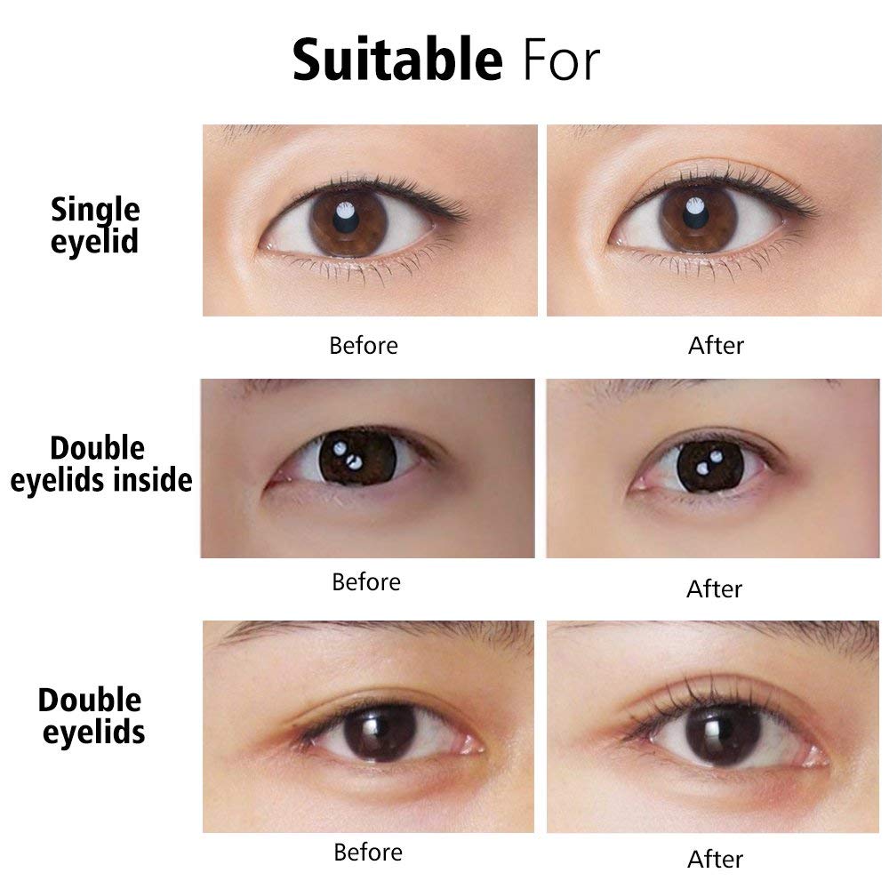 Single Eyelid Vs Double Eyelid