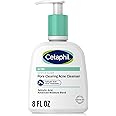 Amazon.com: Cetaphil Gentle Clear Pore Clearing Acne Cleanser, Foaming Gel Cleanser for ...