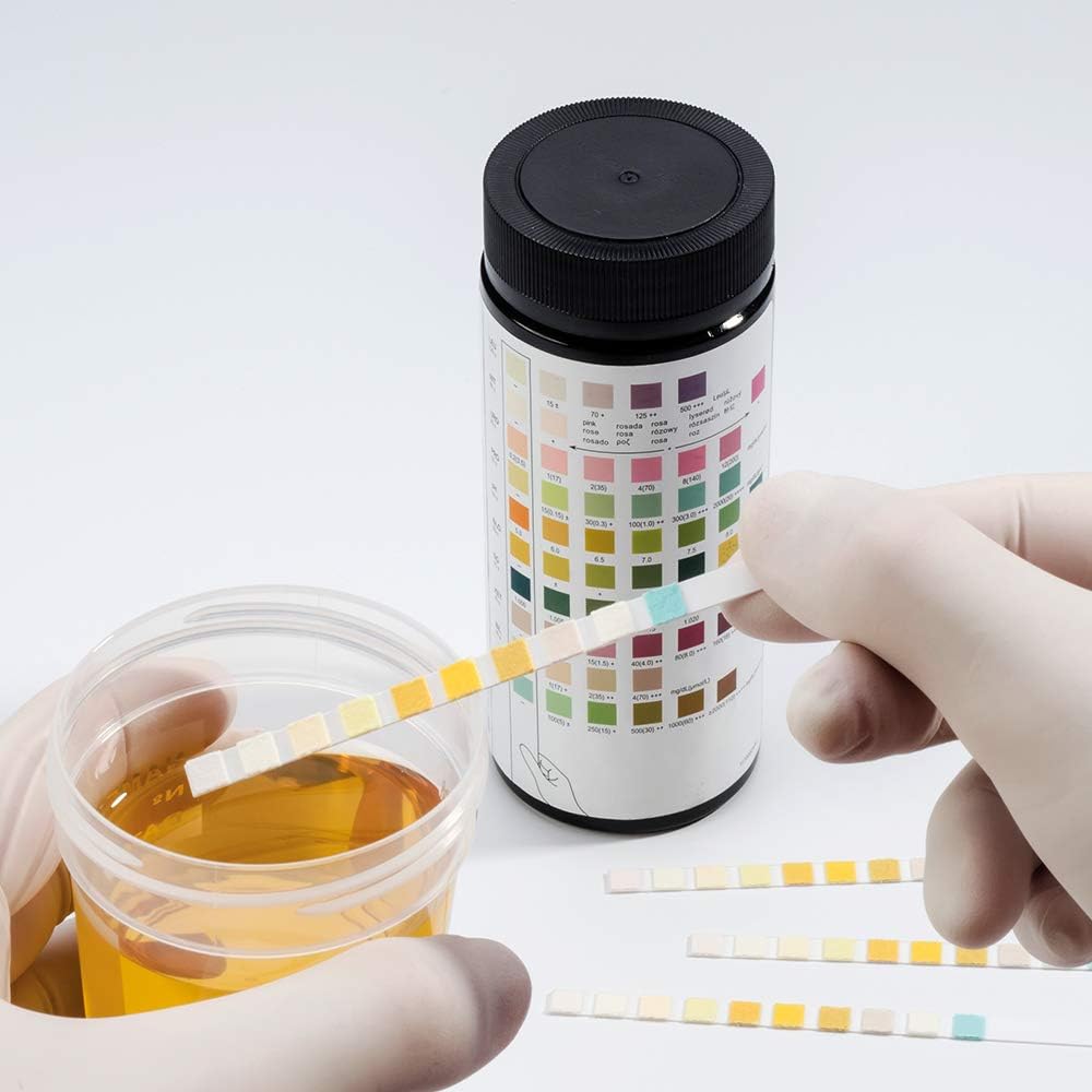 Reactif Urinalysis – Urine Infection Testing Strips – Cystitis UTI Dip ...