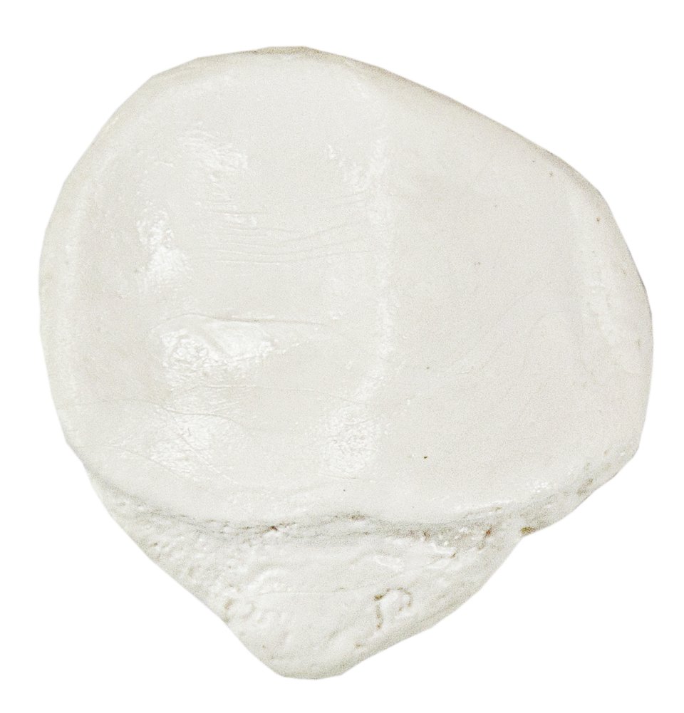 Left 3 Year Warranty Axis Scientific Patella Bone Model Cast from a ...