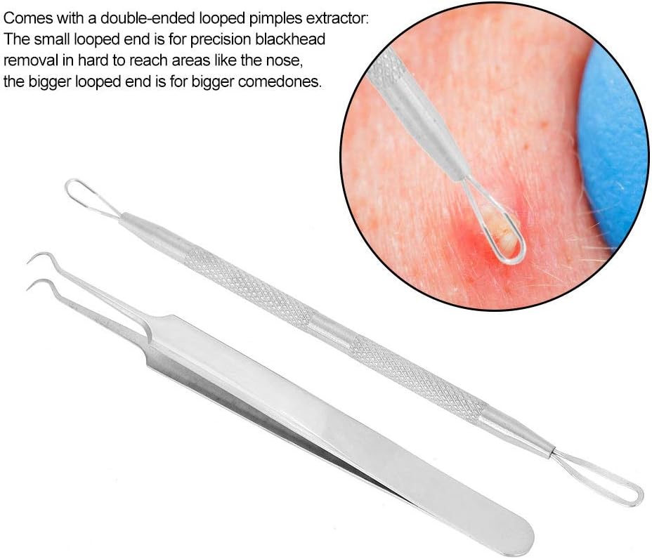 Curved Blackhead Removal, Curved Tweezers for Stainless Steel Blackhead ...