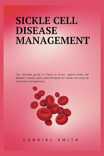 SICKLE CELL DISEASE MANAGEMENT: The ultimate guide on Facts to know ...