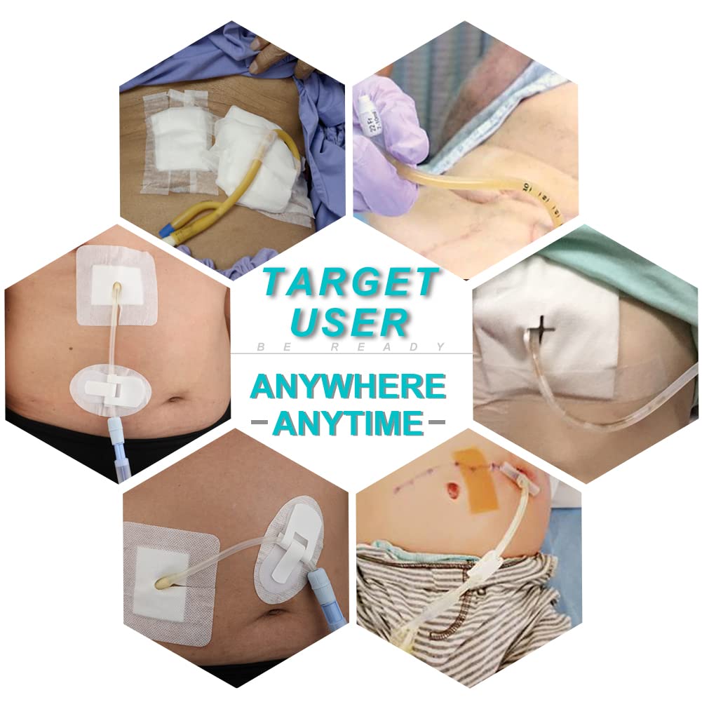 Peritoneal Dialysis PD Catheter Drain Split Bordered Gauze Island Dressing Pad For Stomach ...