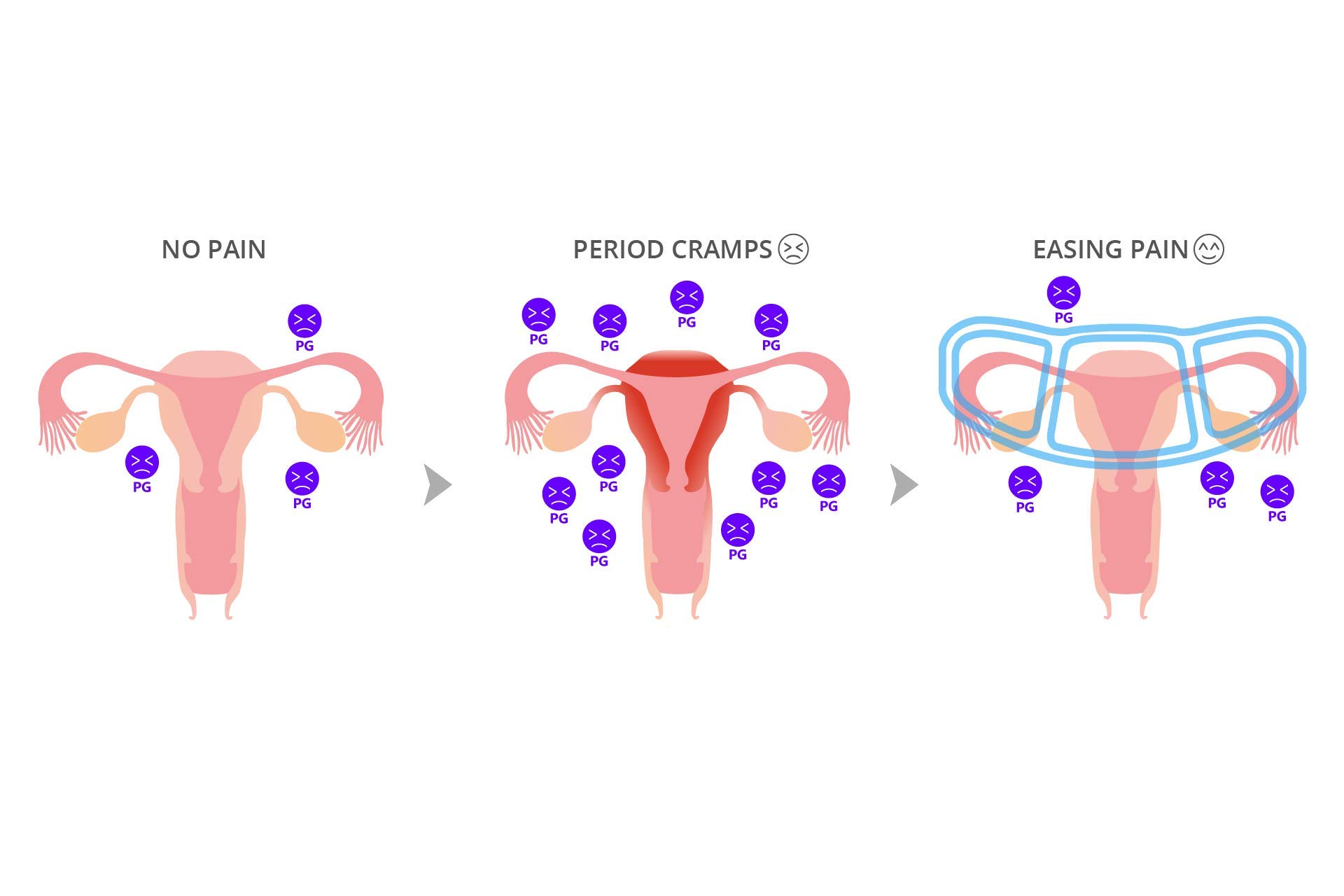 (5 Patches) CrampCareH PMS/Menstrual Cramps Relief Heat Patch with Wide ...