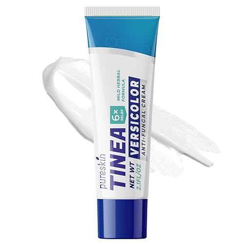 PURESKIN Tinea Versicolor Treatment Antifungal: Natural Anti Fungal ...
