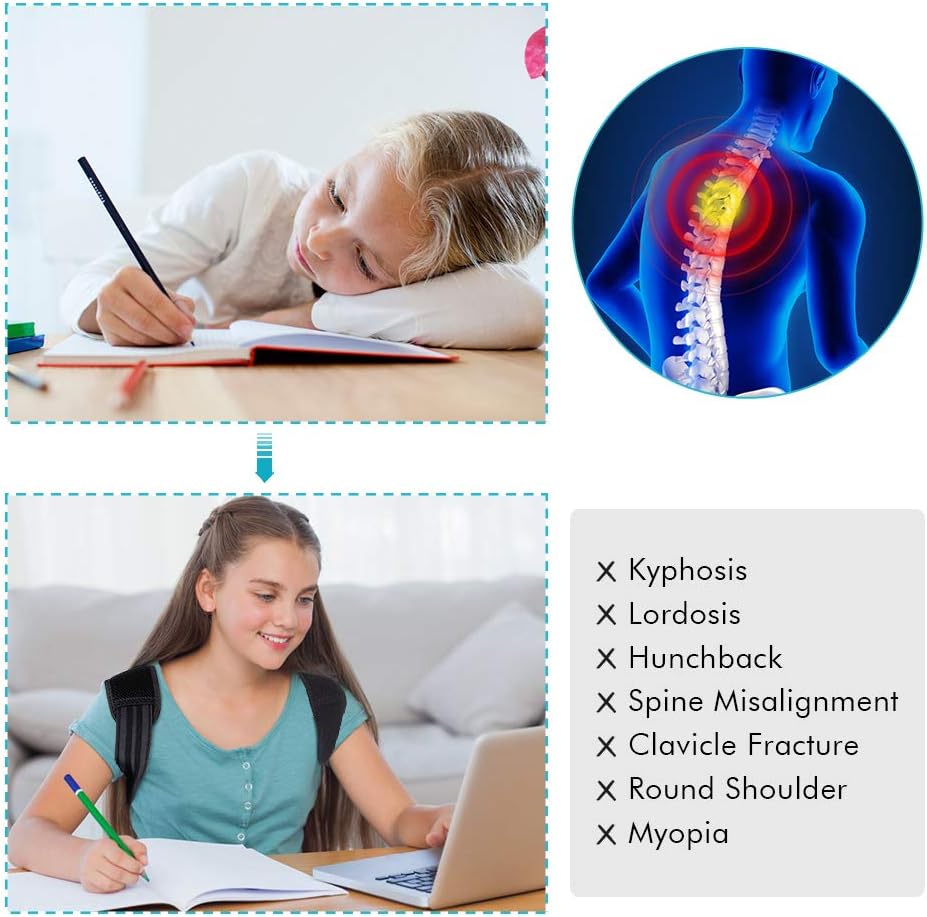 Posture Corrector for Kids Teenagers, Spinal Support Back Posture Brace ...