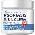 Amazon.com: Bio-MD Psoriasis Eczema Cream, Eczema Cream for Adults ...