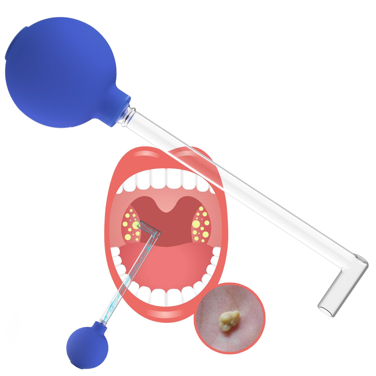 Voraiya Tonsil Stone Remover Vacuum, Tonsil Stone Remover Kit, Tonsil ...