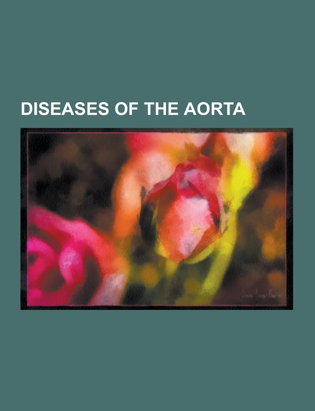 Mua Diseases of the Aorta: Aorta, Abdominal Aortic Aneurysm, Aortic ...