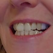 CREADENT Kit for Replacing a Missing Tooth with a Temporary Cosmetic ...