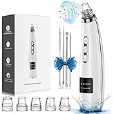 Amazon.com: CHIMOCEE Blackhead Remover Pore Vacuum, Upgraded Black Head Remover for Face ...