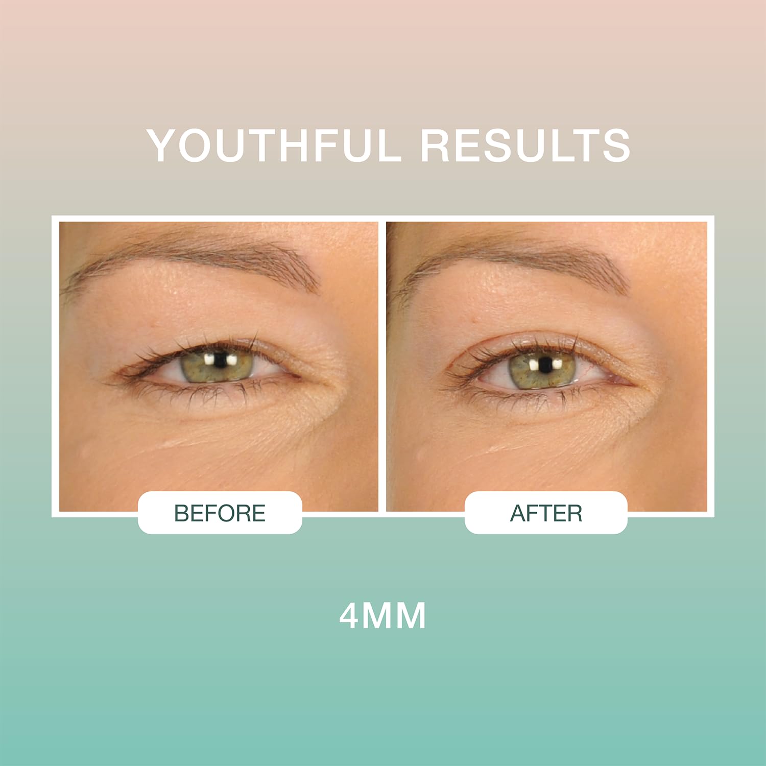 Mua Contours Rx Lids By Design - Non-Surgical & Transparent Eyelid Lift ...