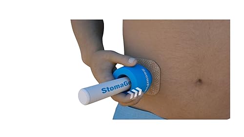 Stoma Secure Device - 1-Pack - (5/8"), for Any Type of Ileostomy ...