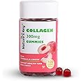 Amazon.com: Nature's Key 300mg Collagen Gummies Beauty Boost with ...