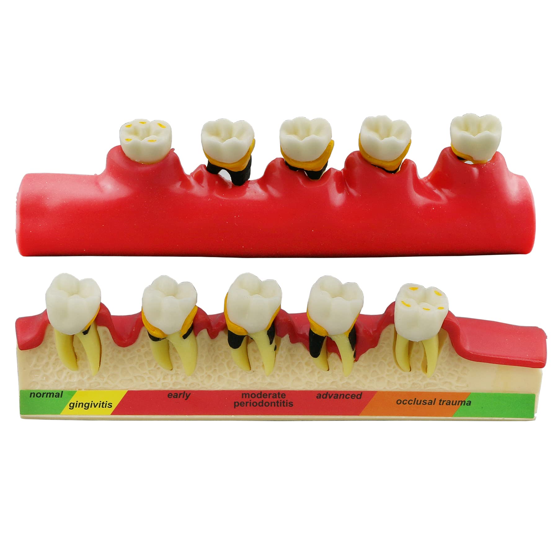 Mua Lab Periodontal Disease Assort Tooth Typodont Teeth Model Study ...