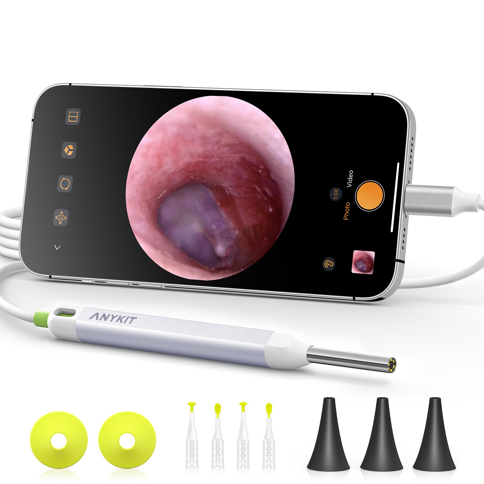 Anykit Digital Otoscope with Gyroscope, HD Ultra Clear View Ear Camera ...