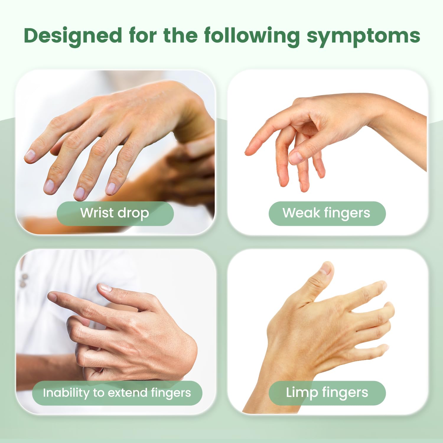 Mua Radial Nerve Palsy Brace Splint for Finger Extension, Wrist Drop ...