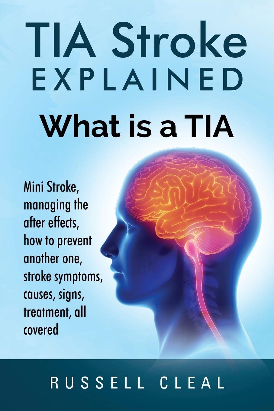 Mini Stroke Tia Stroke Causes Symptoms Signs Treatmen Vrogue co