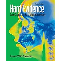 Amazon.com: Hard Evidence: Case Studies in Forensic Anthropology ...
