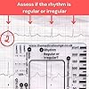 ECG 7 Step Ruler, ECG 7 Step Ruler for ECG/EKG Interpretation, Portable ECG Assessment Tool ...