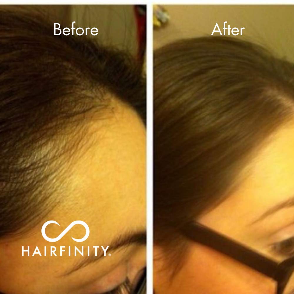 Mua Hairfinity Infinite Edges Hair Serum - Hair Growth Treatment to ...