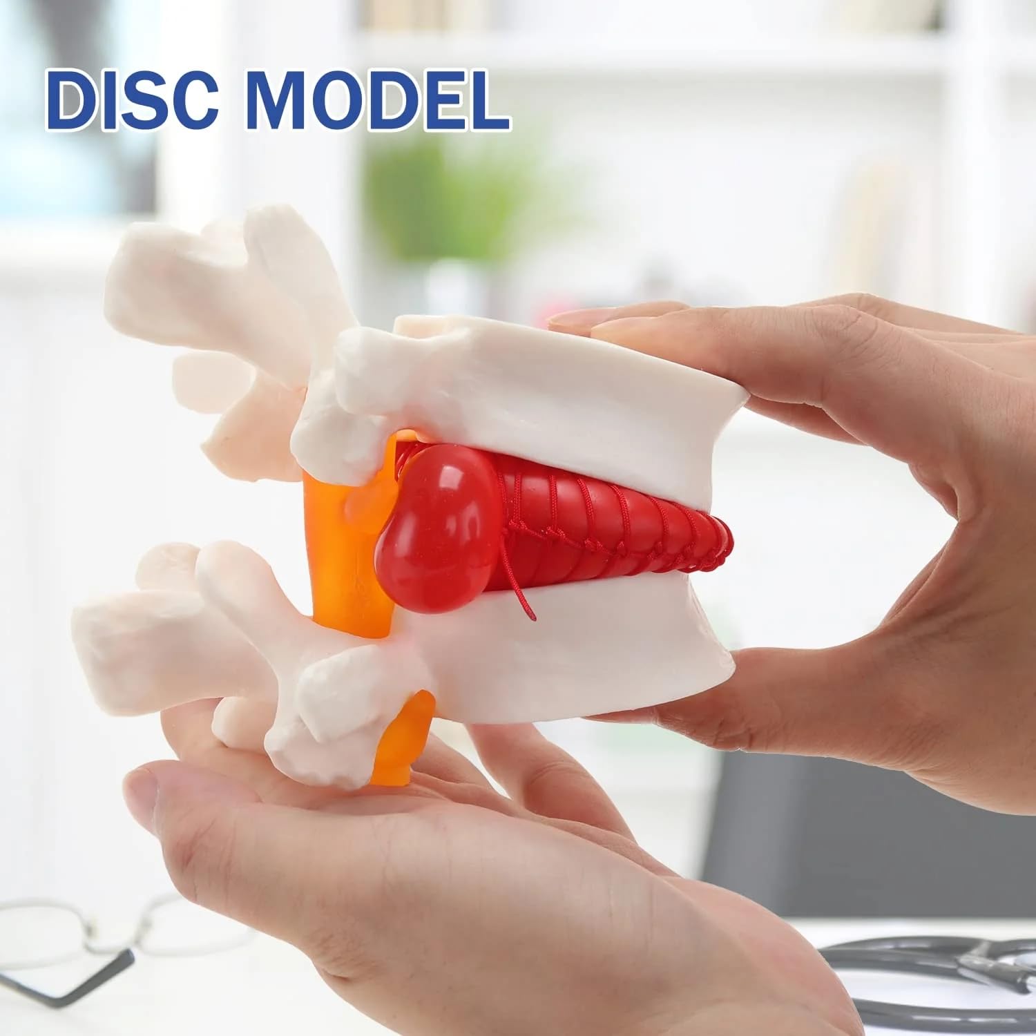 Mua Human Anatomical Lumbar Disc Herniation Model - Lumbar Spine Model ...