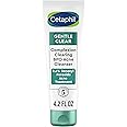 Amazon.com: Cetaphil Gentle Clear Complexion-Clearing BPO Acne Cleanser with 2.6% Benzoyl ...