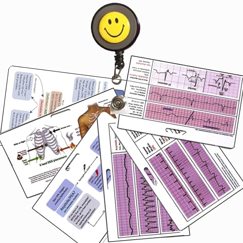 6 EKG Badge Cards, Cardiac Badge Reference + (EKG Cheat Sheets PDF ...