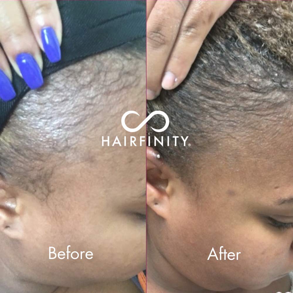 Mua Hairfinity Infinite Edges Hair Serum - Hair Growth Treatment to ...