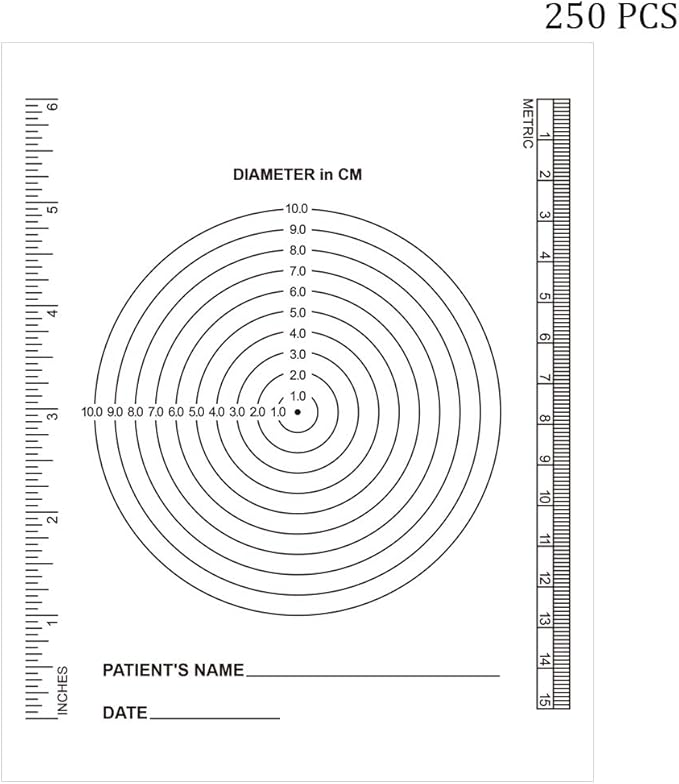 Amazon.com: Edtape (Pack of 250) Wound Measurement Tools Wound ...