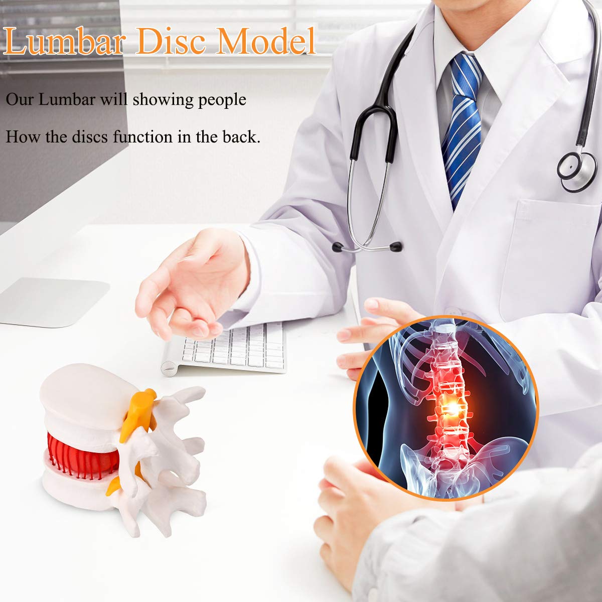Mua Human Anatomical Lumbar Disc Herniation Model, Life Size Lumbar ...