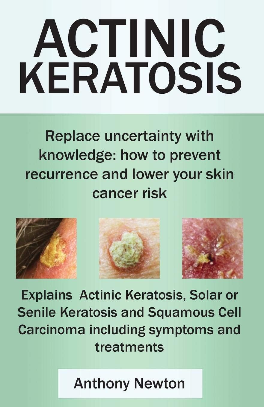 Actinic Keratosis. Replace the Fear and Uncertainty with Knowledge: How ...