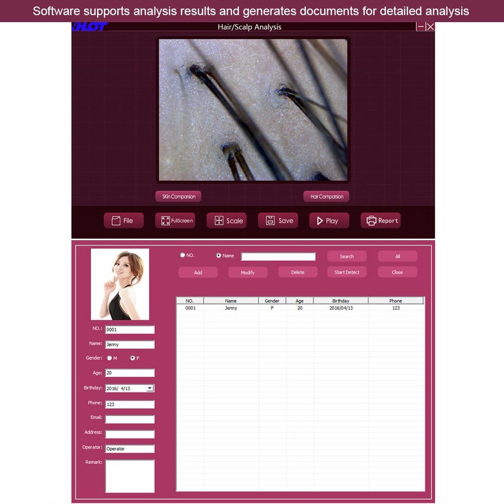 Digital Microscope,USB Skin Hair Scalp Detector Digital Microscope Skin ...