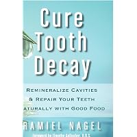 Cure Tooth Decay: Remineralize Cavities and Repair Your Teeth Naturally ...