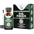 Amazon.com : FootCure Extra Strong Finger & Toenail Fungus Treatment - Made In USA, Best Nail ...