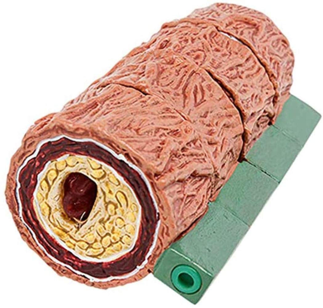 Buy XUHRA 4 Piece Artery Model - Blood Vessel Anatomical Model - Human ...