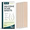 Silicone Scar Sheets, Tape, Strips, 16 Pcs 5.9"x1.6", Healing Keloid, C ...