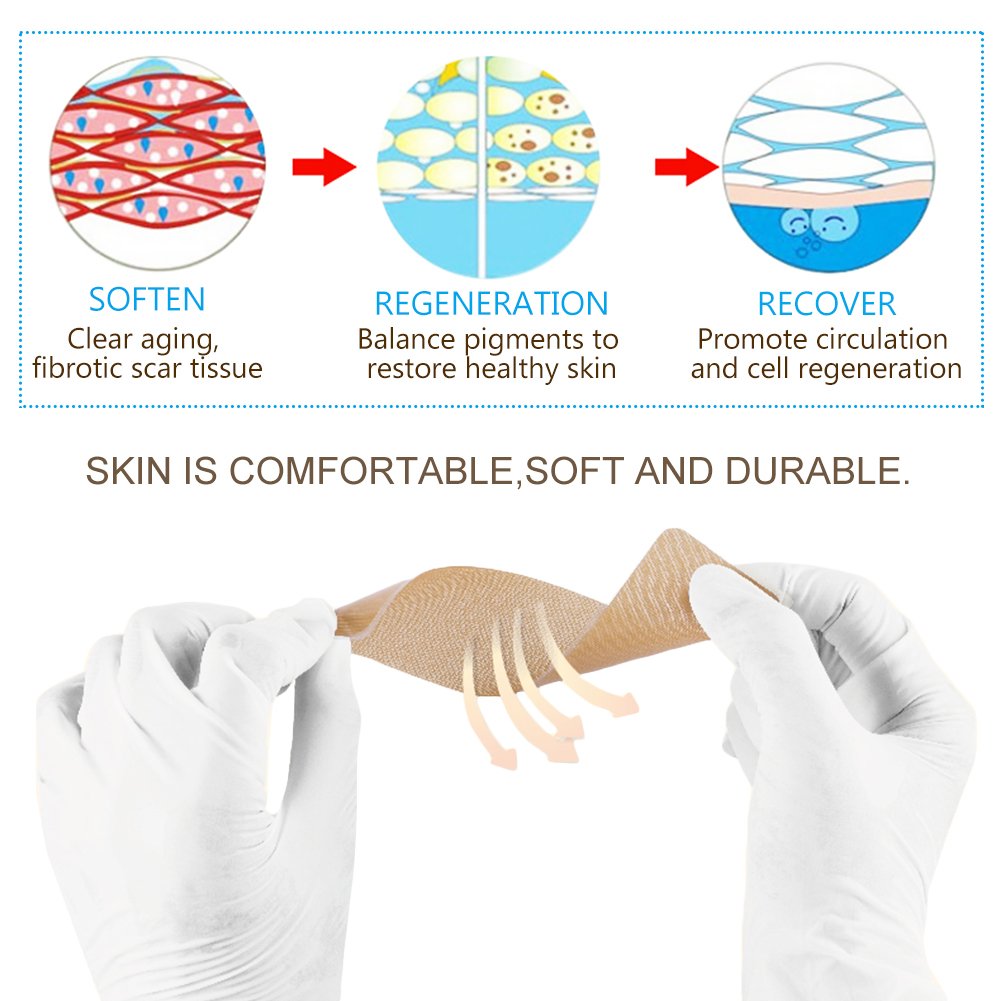 Silicone Scar Strips Silicone Scar Sheets C Section Scar Gel Silicone ...