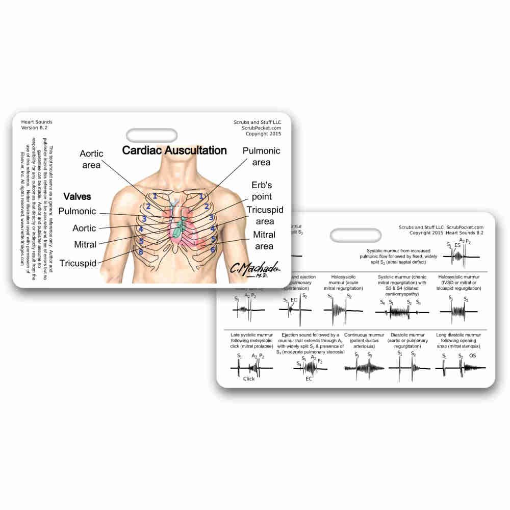Amazon.com: 12 Lead EKG Placement Horizontal Badge Reference Card (Pack ...