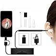 Amazon.com: USB Otoscope-Ear Scope Camera, 3-in-1 Digital Led Otoscope ...