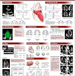 Guidelines for Chamber Quantification of the Left Heart Poster ...