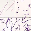 Bacteria Types Slide, Separate Smears, Gram Stain in Oman | Whizz ...