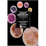 Atlas of Dermoscopy: Third Edition: Marghoob, Ashfaq A, Jaimes, Natalia ...