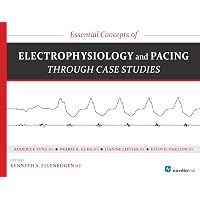 Essential Concepts of Electrophysiology and Pacing through Case Studies ...