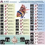 Performing a Comprehensive Intraoperative Multiplane TEE Exam Poster (ASE Guidelines Posters ...