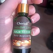 Amazon.com : Hair Growth Serum, Hair Loss &Hair Thinning Treatment ...