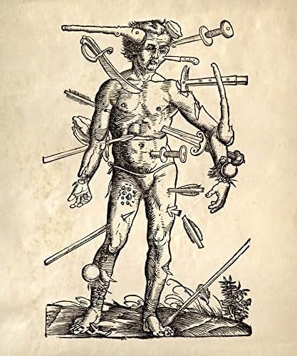 Amazon.com: 16" x 20" Vintage Anatomy Illustration of the Wounded Man ...
